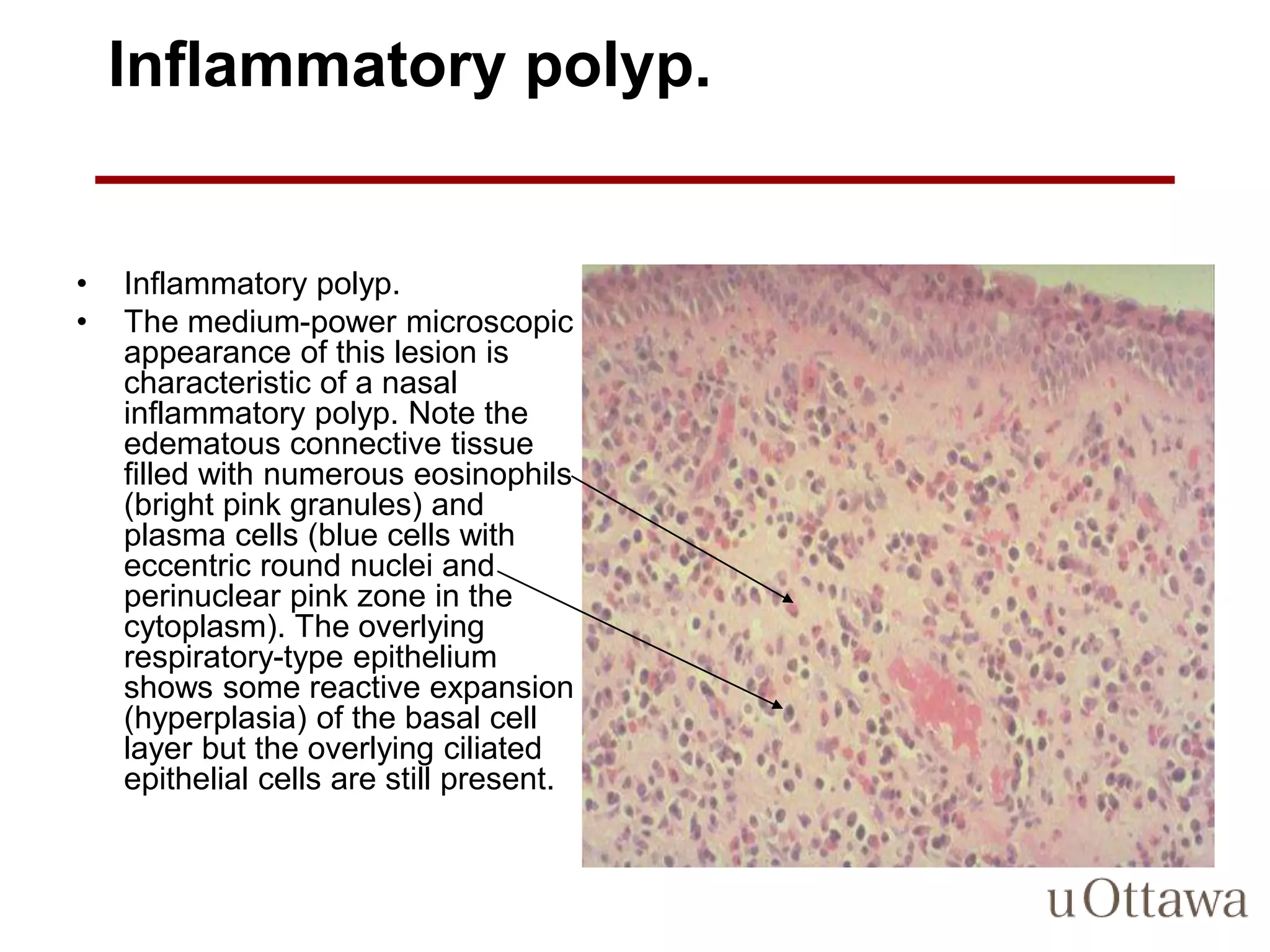 Sinus Pathology.ppt