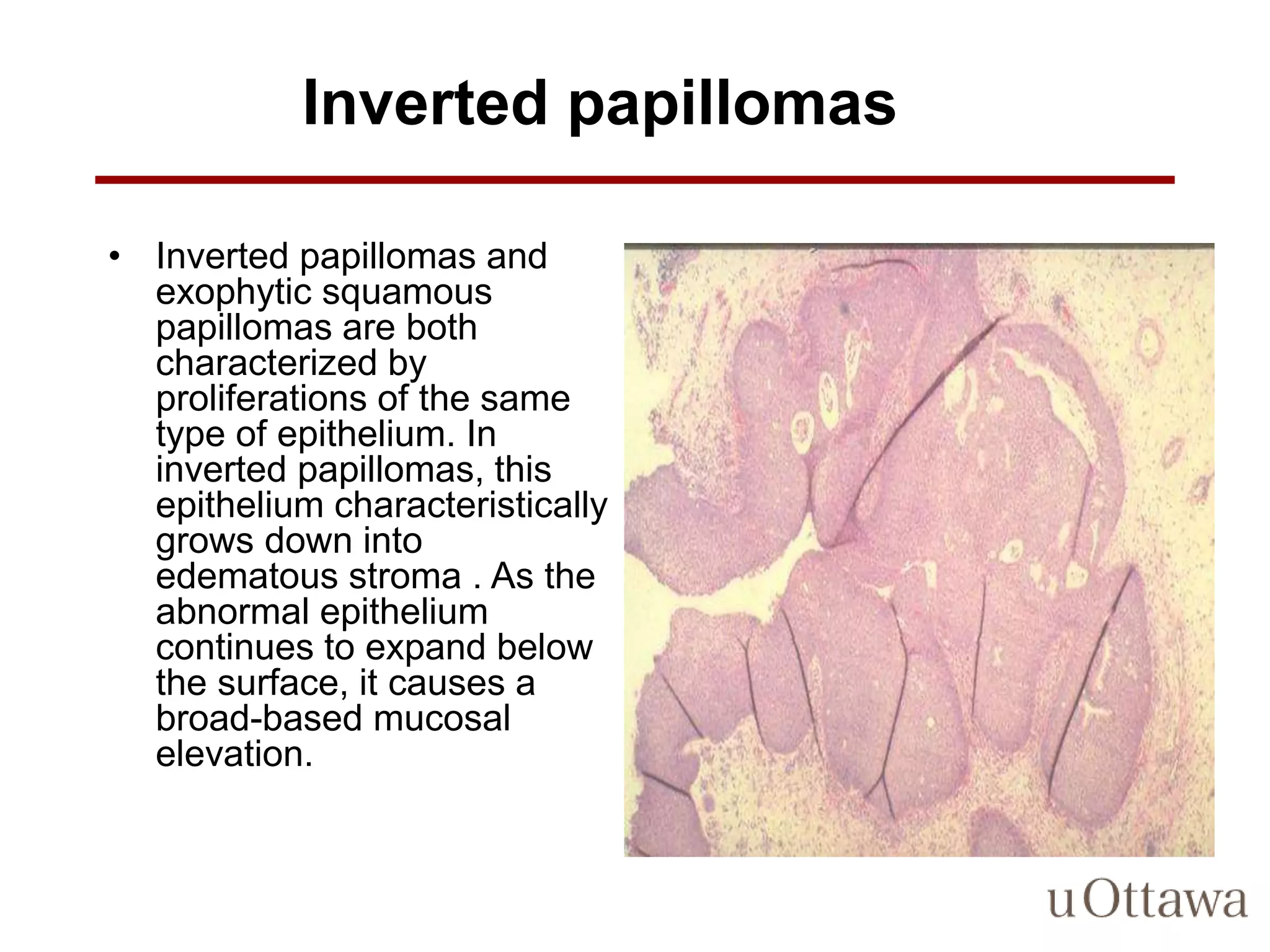 Sinus Pathology.ppt