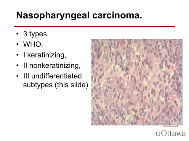 Sinus Pathology.ppt