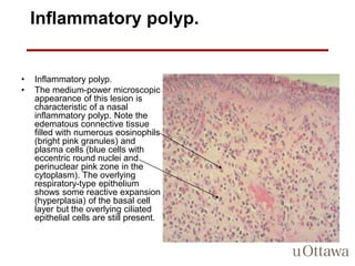 Sinus Pathology.ppt