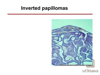 Sinus Pathology.ppt