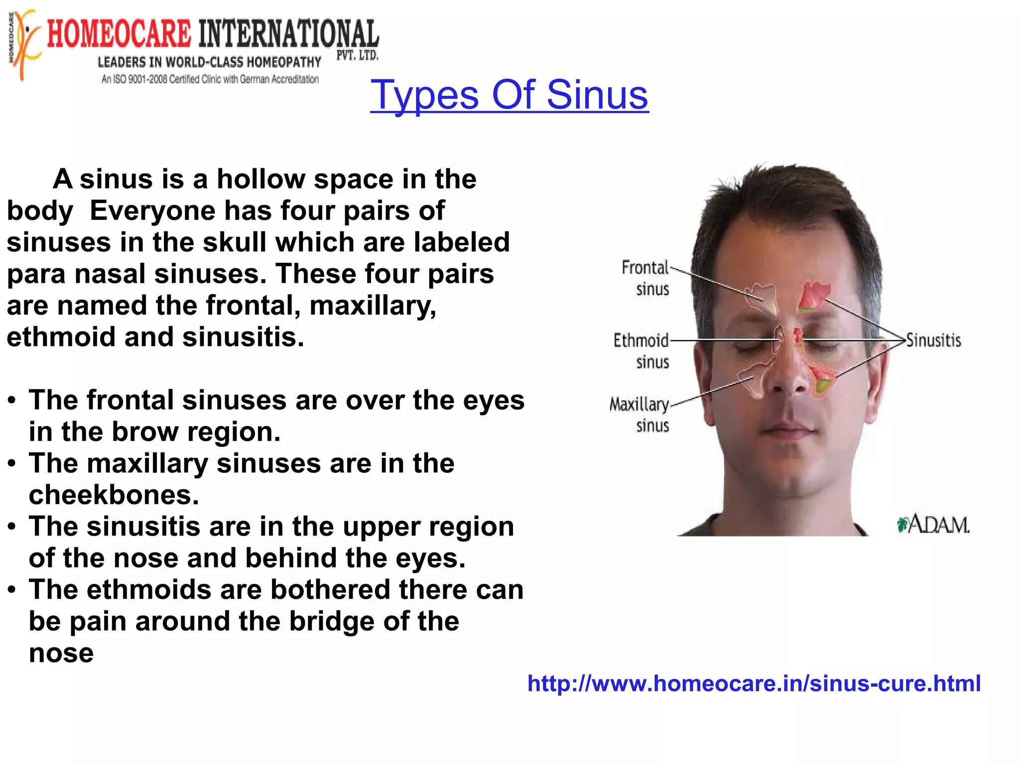 Sinus treatment in homeopathy | PPT
