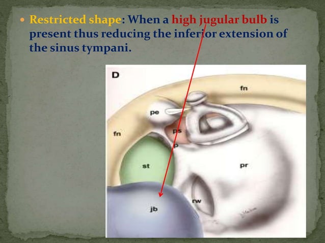 Sinus tympani prof dr bikash