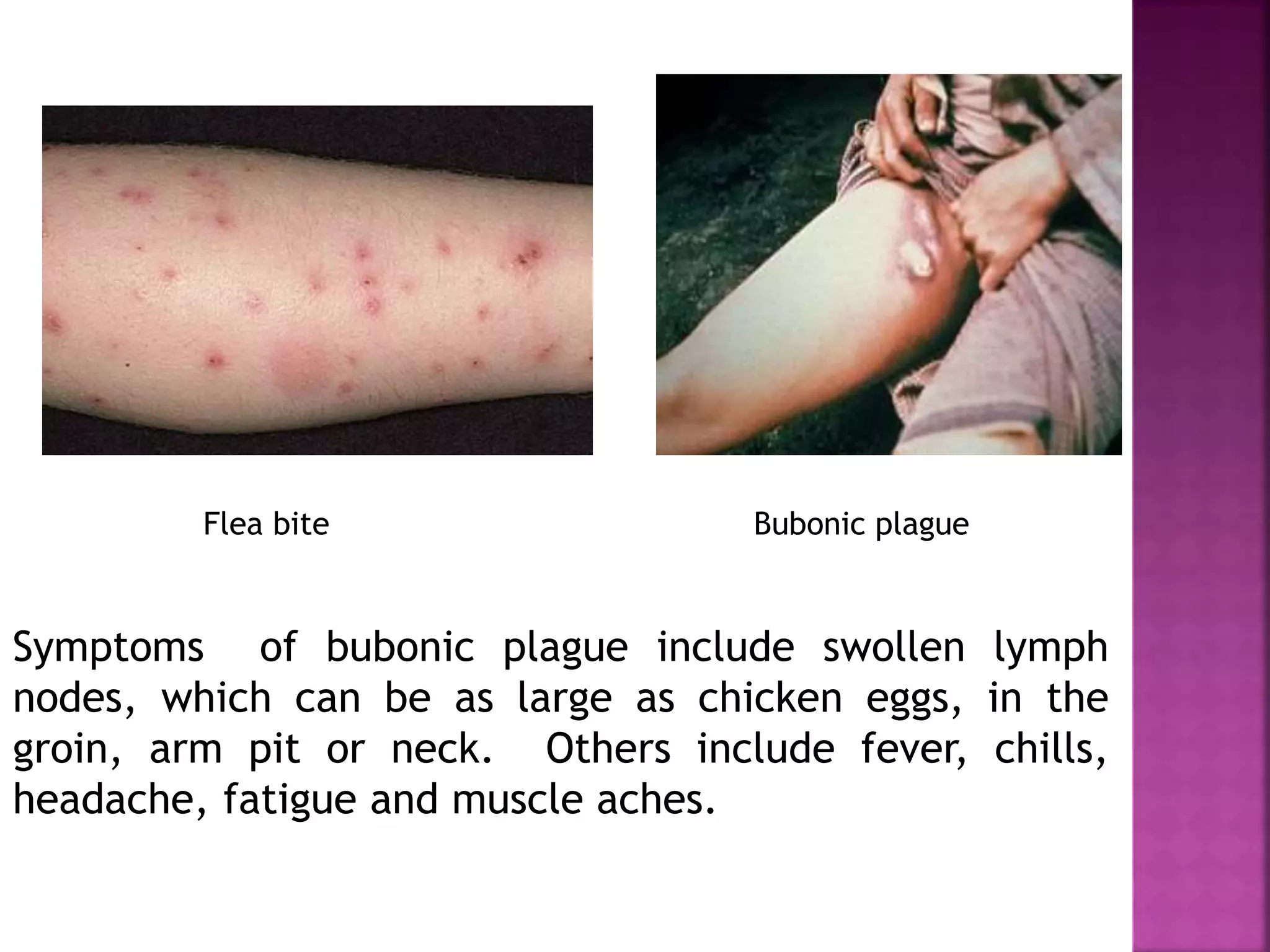Siphonaptera & strepsiptera | PPTX