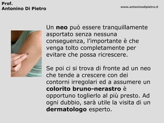 Si possono togliere i nei? | PPT