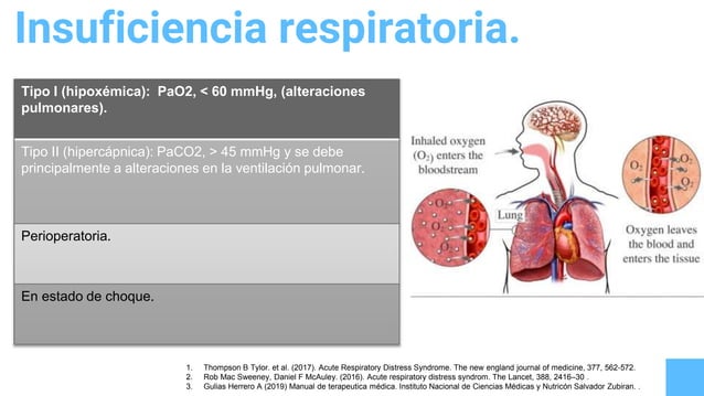 SIRA ( Síndrome de Insuficiencia Respiratoria Aguda) Moisés Olvera ...