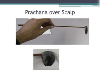 Blood letting or Siravyadha in kampo | PPTX | First Aid | Injuries