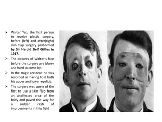 Sir harold delf gillies father of modern plastic surgery | PPT