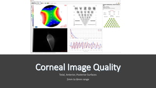 Sirius CSO The other face of Pentacam | PDF
