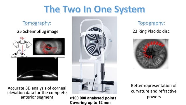 Sirius CSO The other face of Pentacam | PDF | Eye and Vision Conditions ...