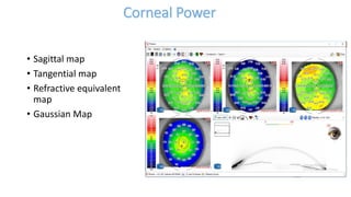 Sirius CSO The other face of Pentacam | PDF