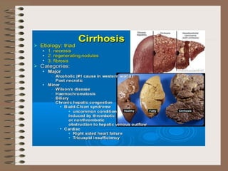 tutorial-Sirosis hepatis | PPT