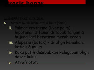 SIROSIS HEPAR | PPT