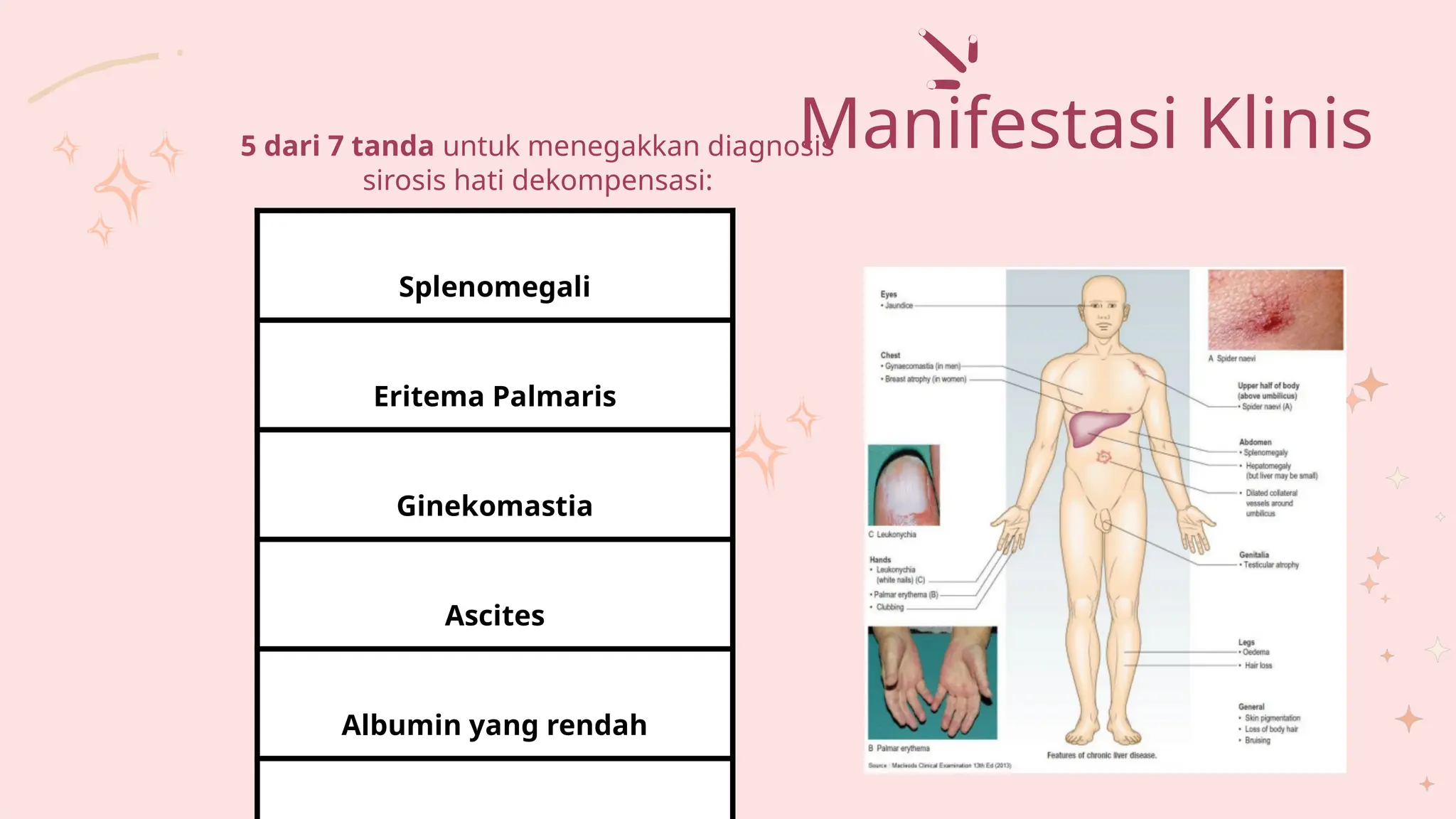 sirosis hepatis sirosis hepatis sirosiss | PPTX
