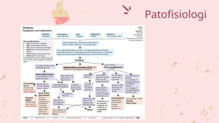 sirosis hepatis sirosis hepatis sirosiss | PPTX