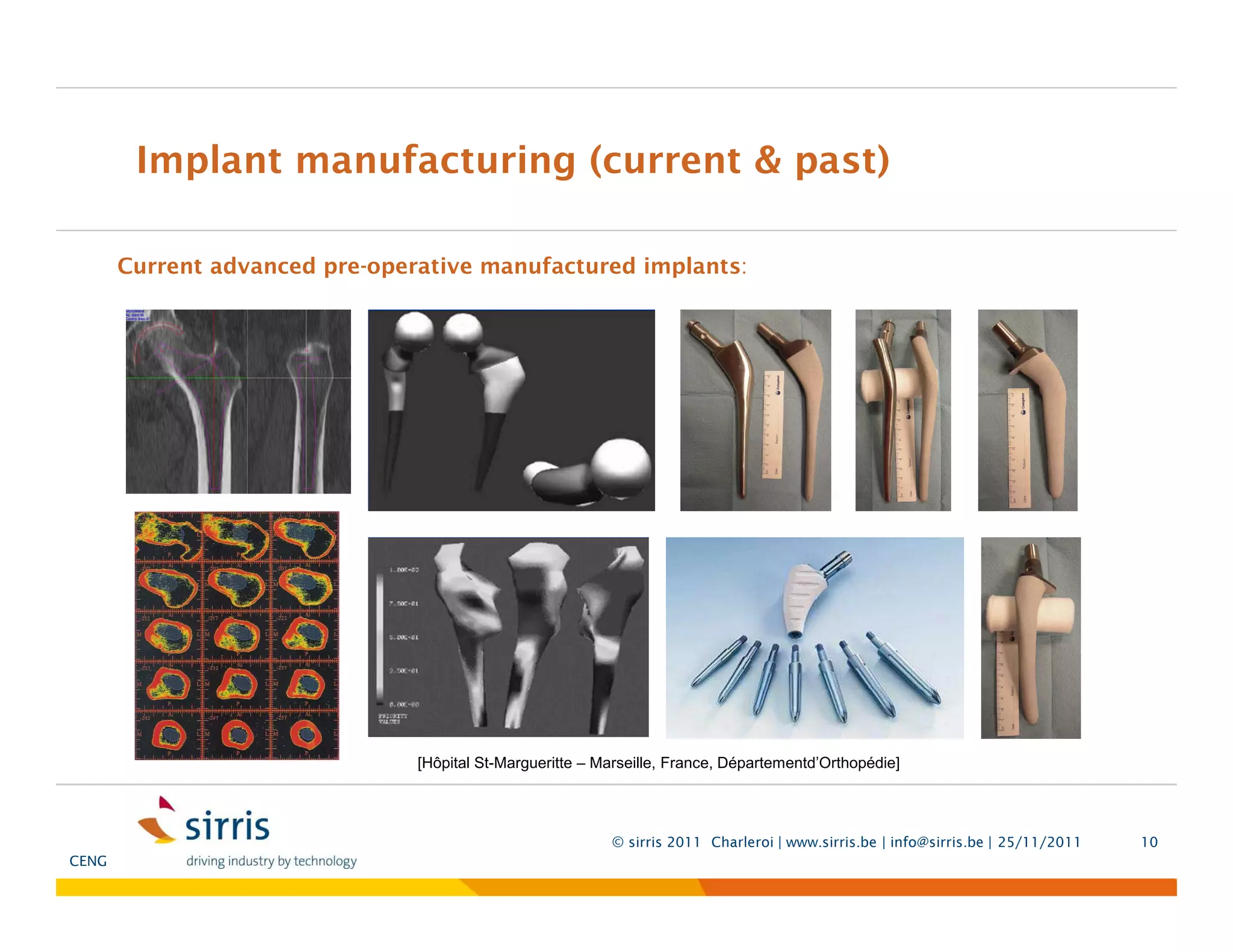 Medical applications of Additive Manufacturing Technologies in general ...