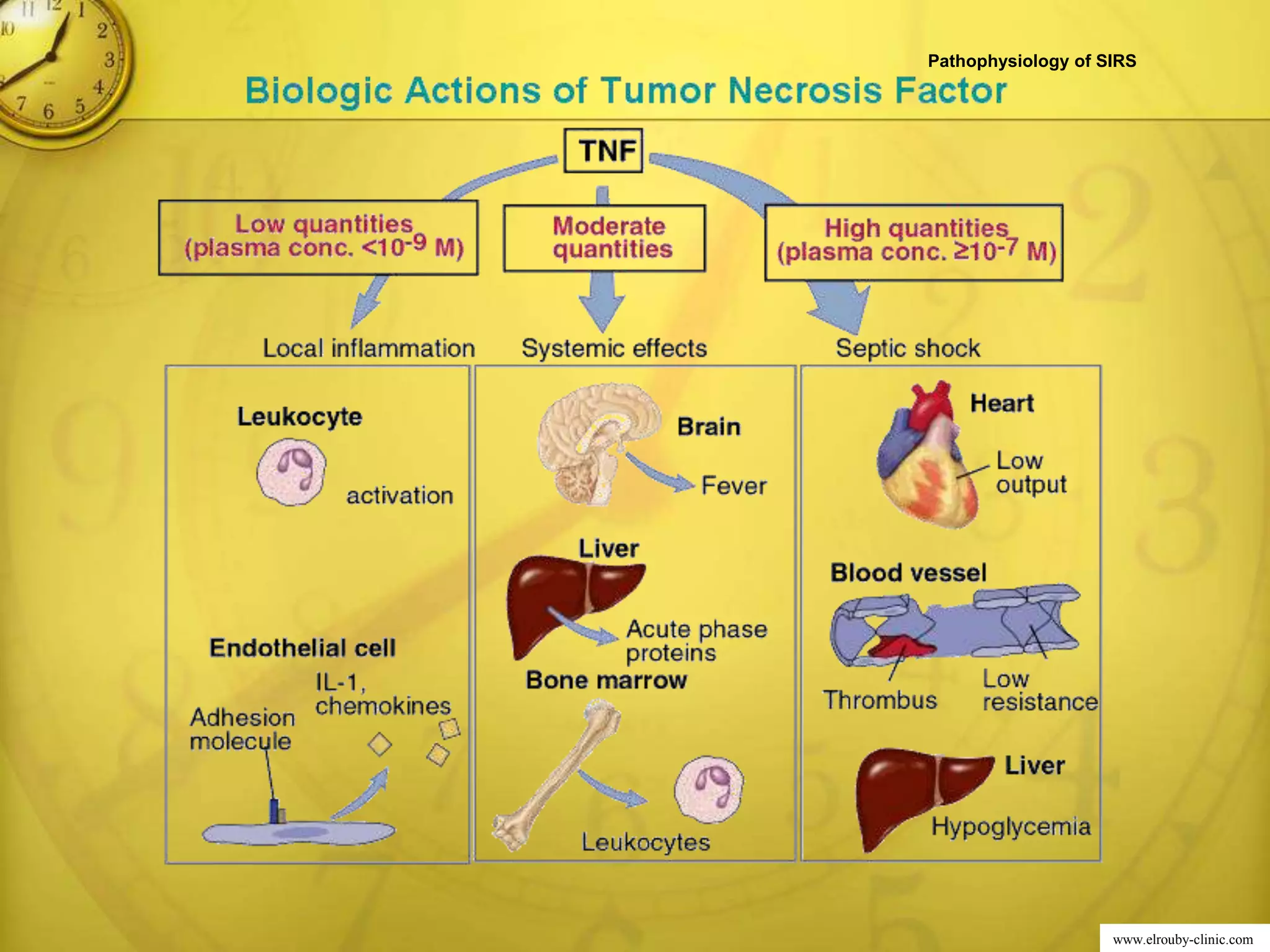 Systemic Inflammatory Response Syndrome Ppt Lung And Respiratory