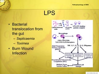 Systemic Inflammatory Response Syndrome | PPT