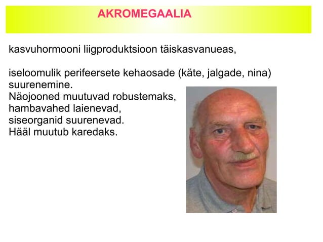 Sisen.Haigused | ODP