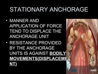 Anchorage in orthodontics | PPT