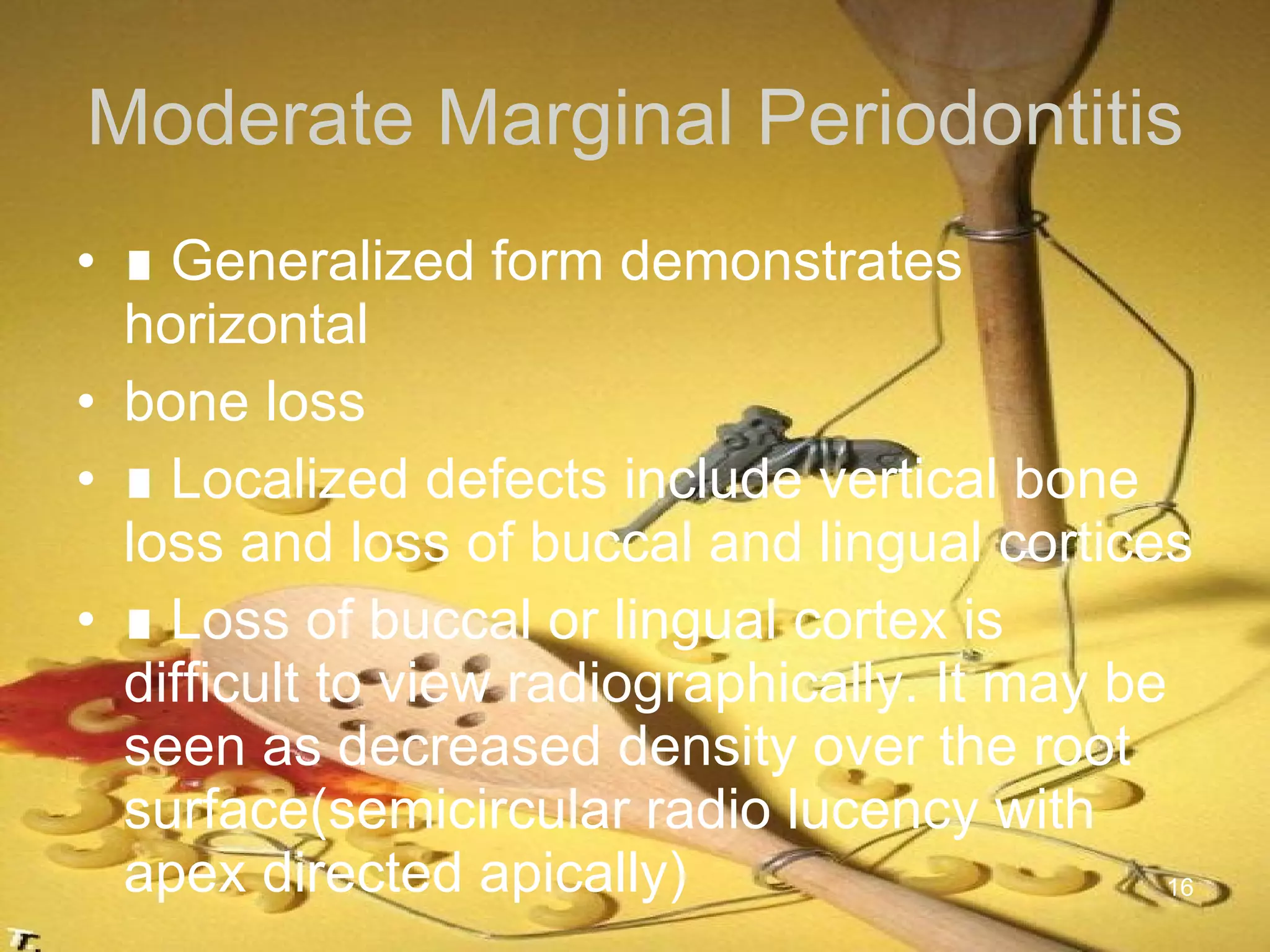 radiographic diagnosis of periodontal disease | PPT