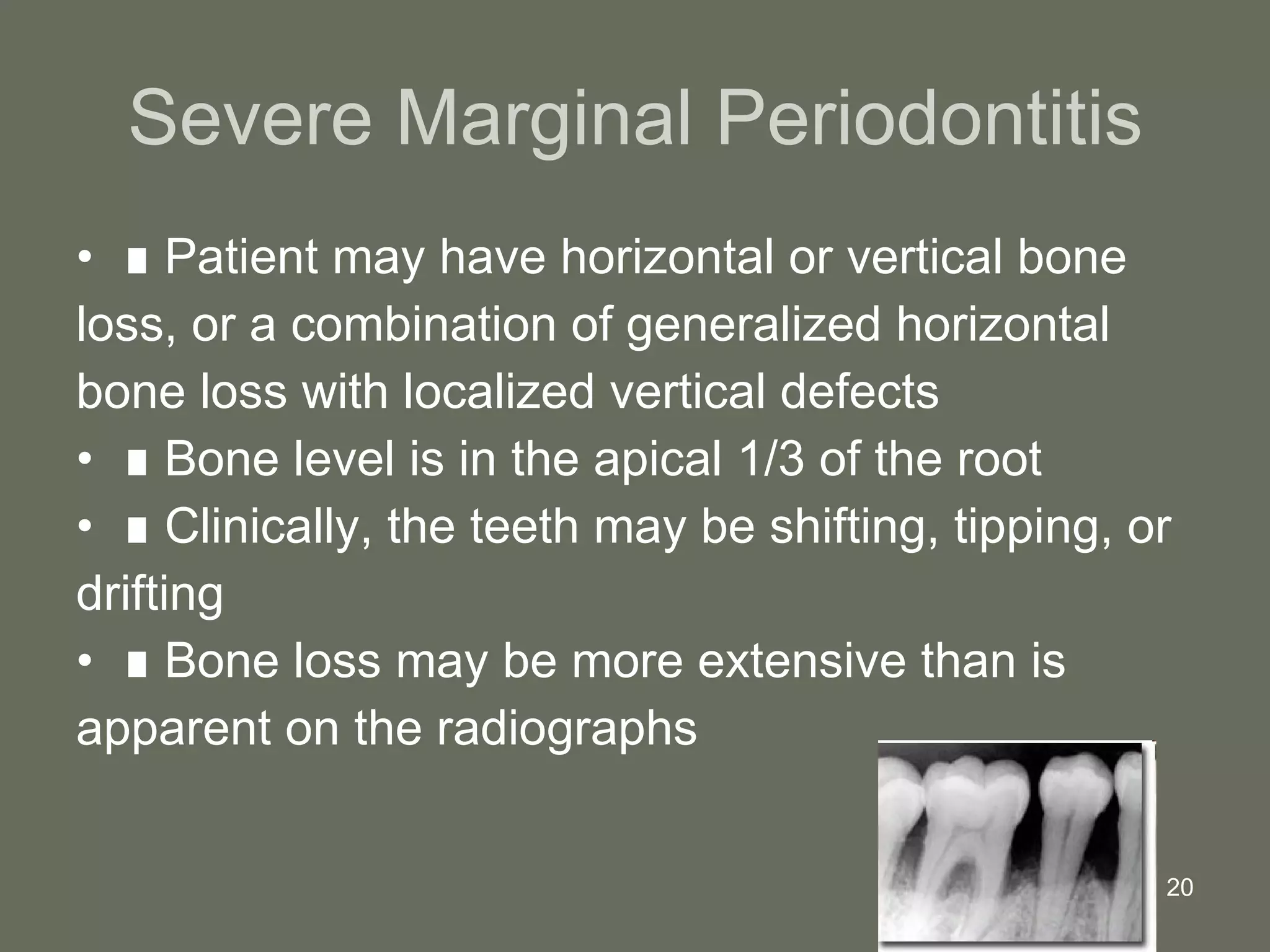 radiographic diagnosis of periodontal disease | PPT