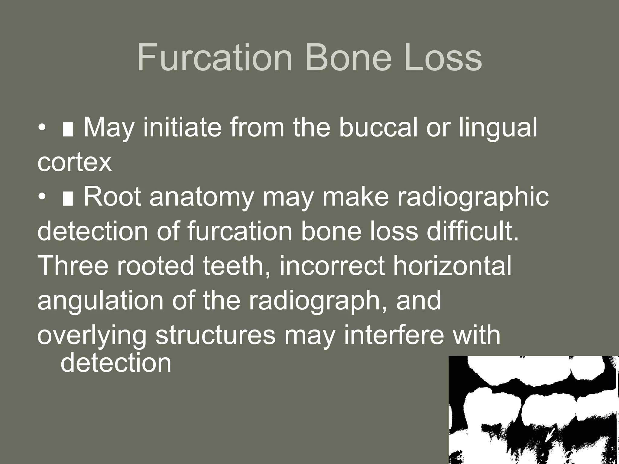 radiographic diagnosis of periodontal disease | PPT