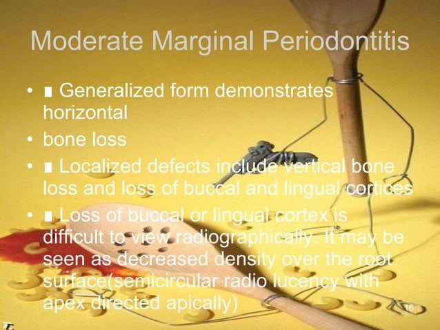 radiographic diagnosis of periodontal disease | PPT | Bone and Joint ...