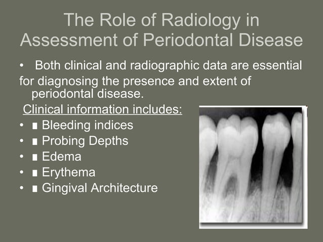 radiographic diagnosis of periodontal disease | PPT | Bone and Joint ...