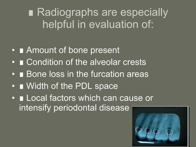radiographic diagnosis of periodontal disease | PPT | Bone and Joint ...