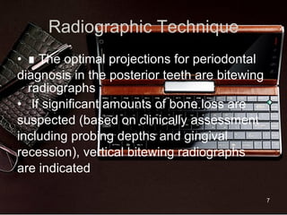 radiographic diagnosis of periodontal disease | PPT