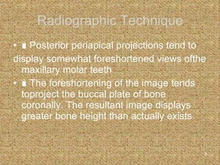 radiographic diagnosis of periodontal disease | PPT