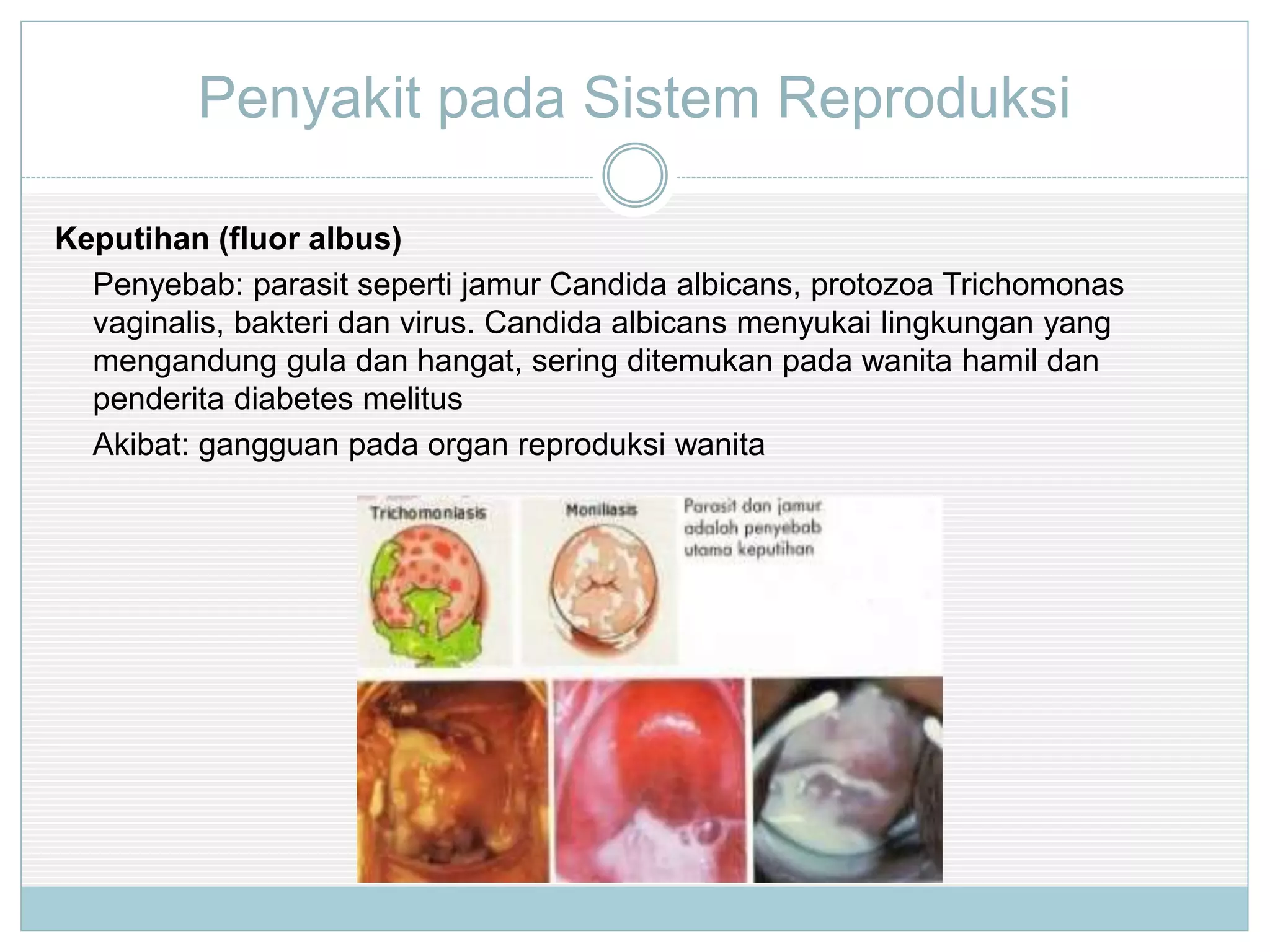 Sistem Reproduksi Pada Manusia Pptx 7440