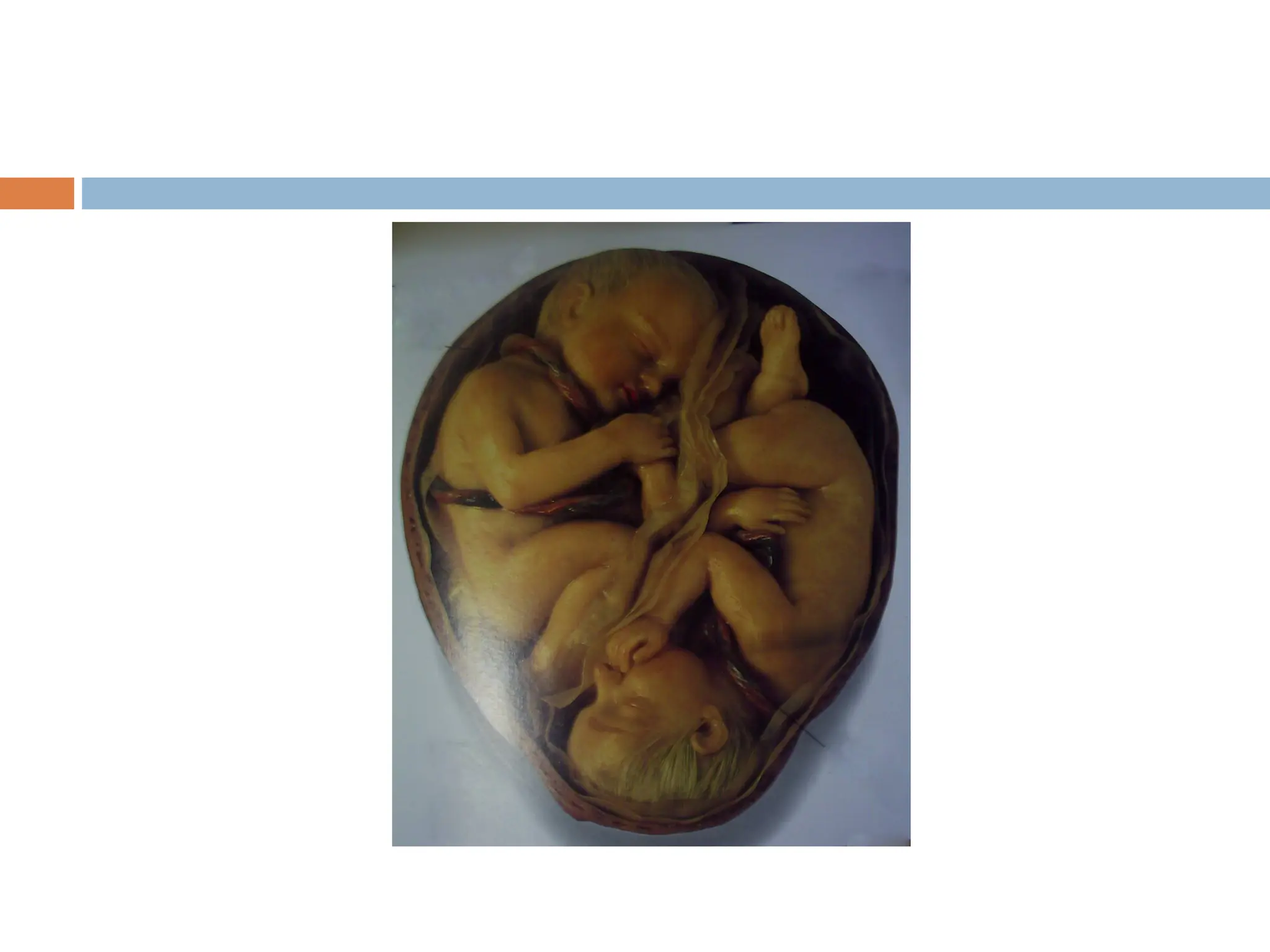 sistem-reproduksi-pada-manusia pria dan wanita | PPT