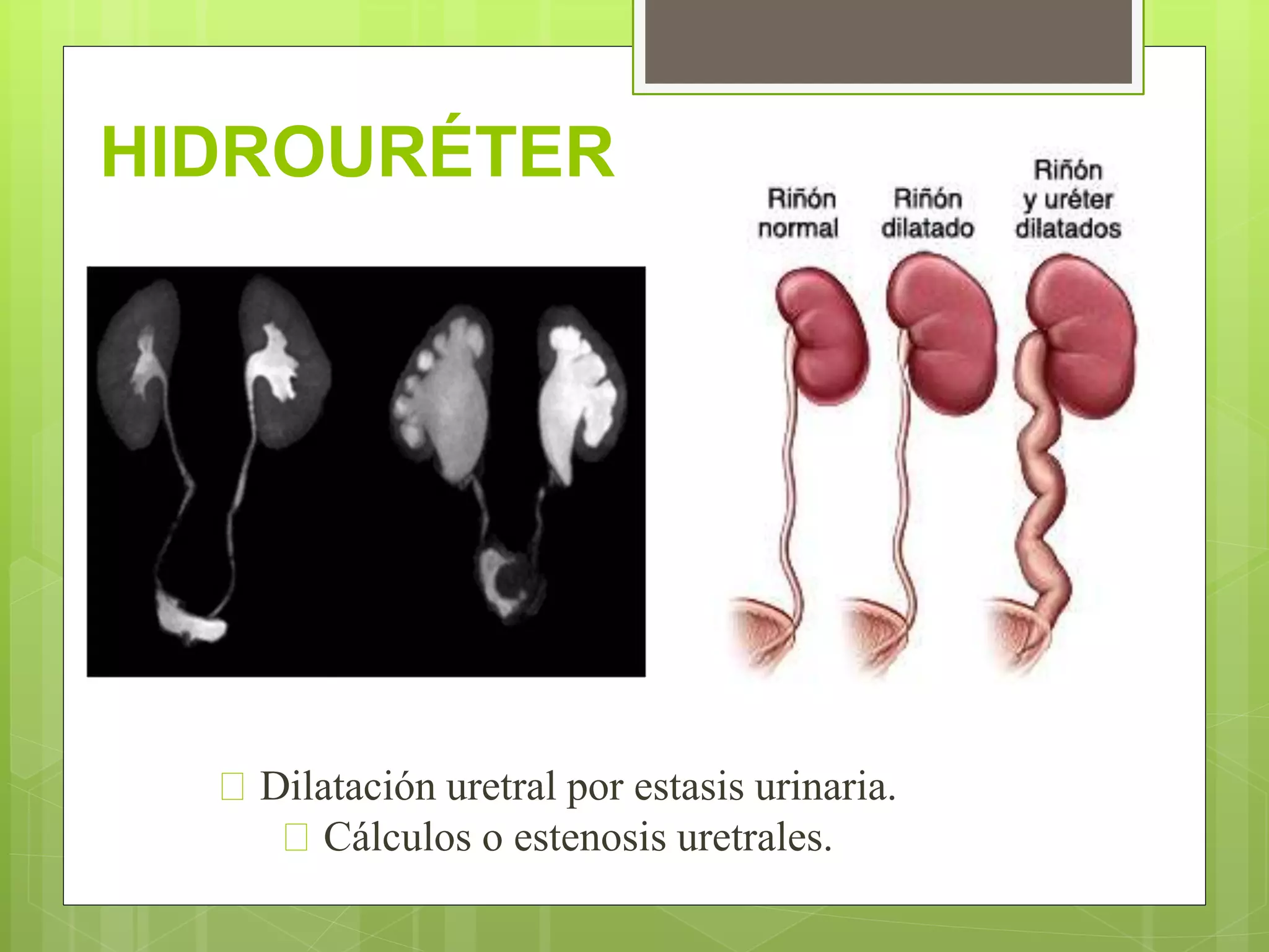 Histologia Sistema Urinario