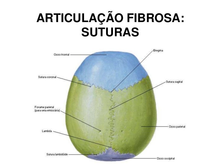 Sistema articular