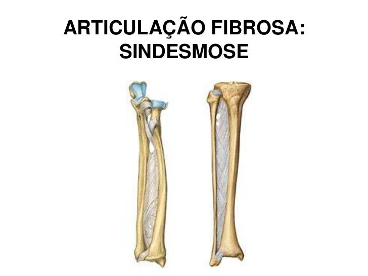 Sistema articular