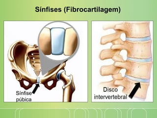 Sistema Articular | PDF