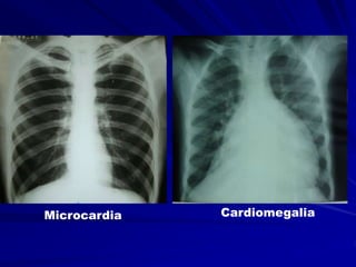RADIOLOGIA - Sistema cardiovascular | PPT