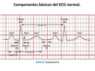Sistema de conducción eléctrica del corazón. Bases eléctricas del ecg ...