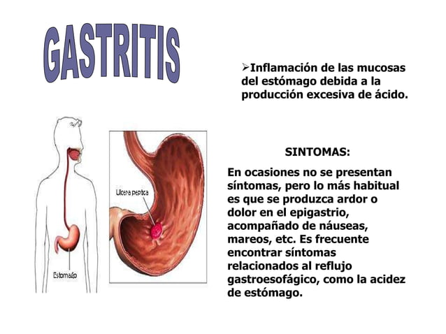 Foto De Enfermedades Del Sistema Digestivo