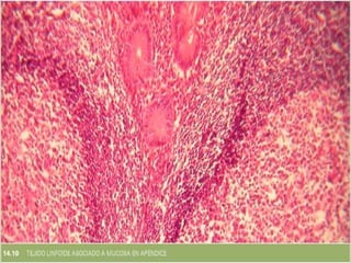 Histologia del Sistema Linfoide | PPTX