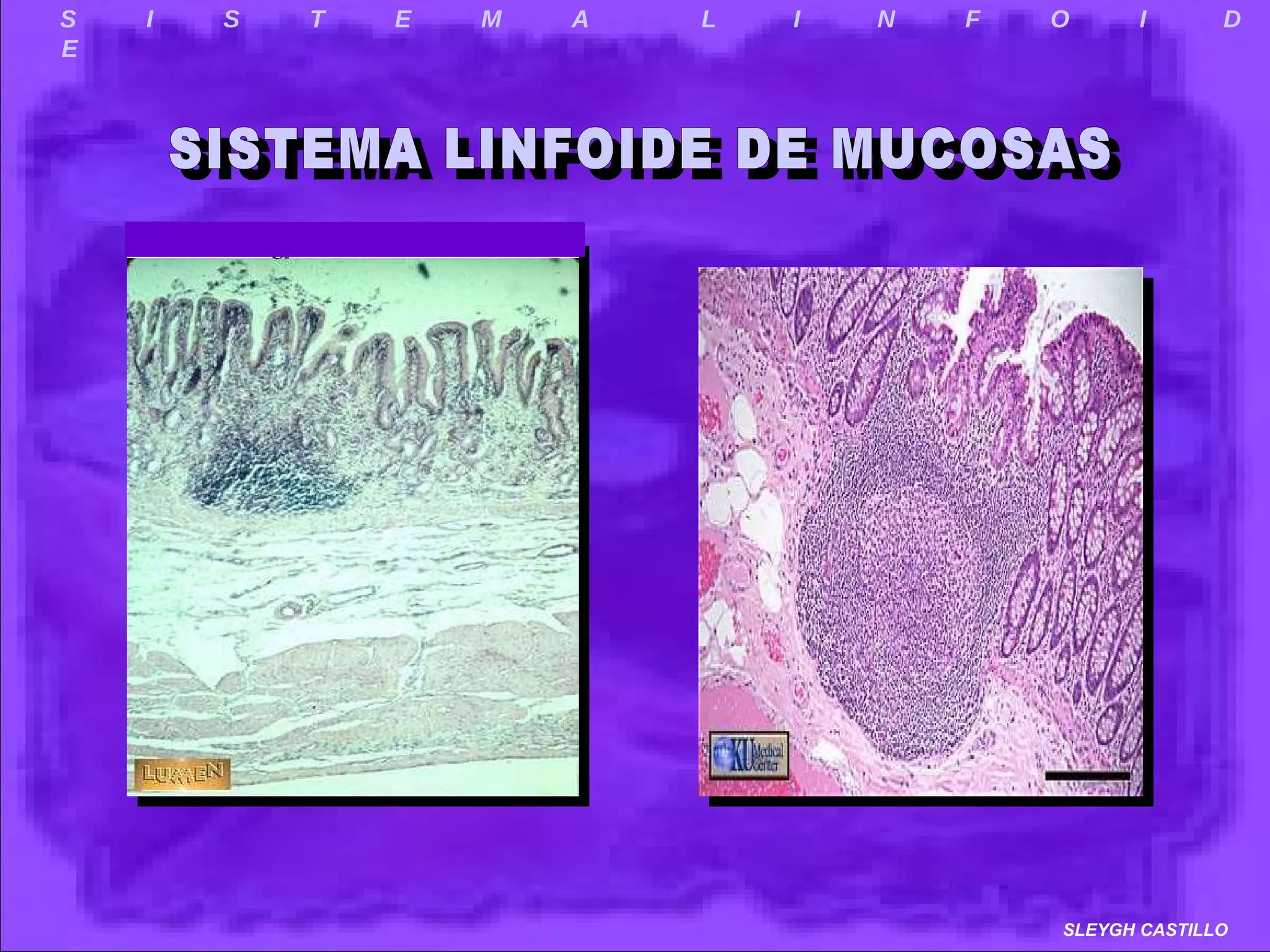 Sistema Linfoide Ucv 2006 | PPT | Blood Disorders | Diseases and Conditions