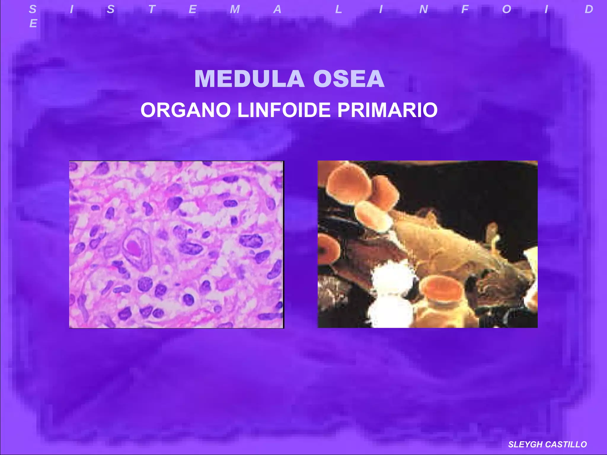 Sistema Linfoide Ucv 2006 | PPT | Blood Disorders | Diseases and Conditions