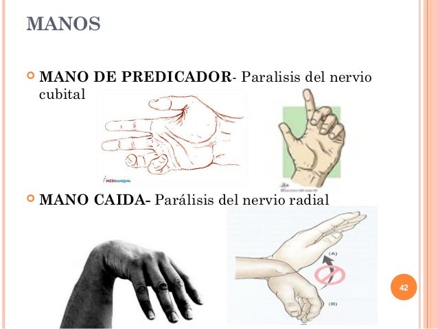 Sistema locomotor- Semiologia