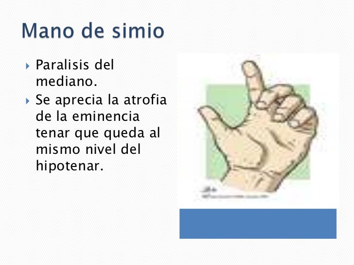 Sistema nervioso124 126