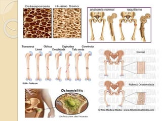 Sistema oseo muscular copia | PPT