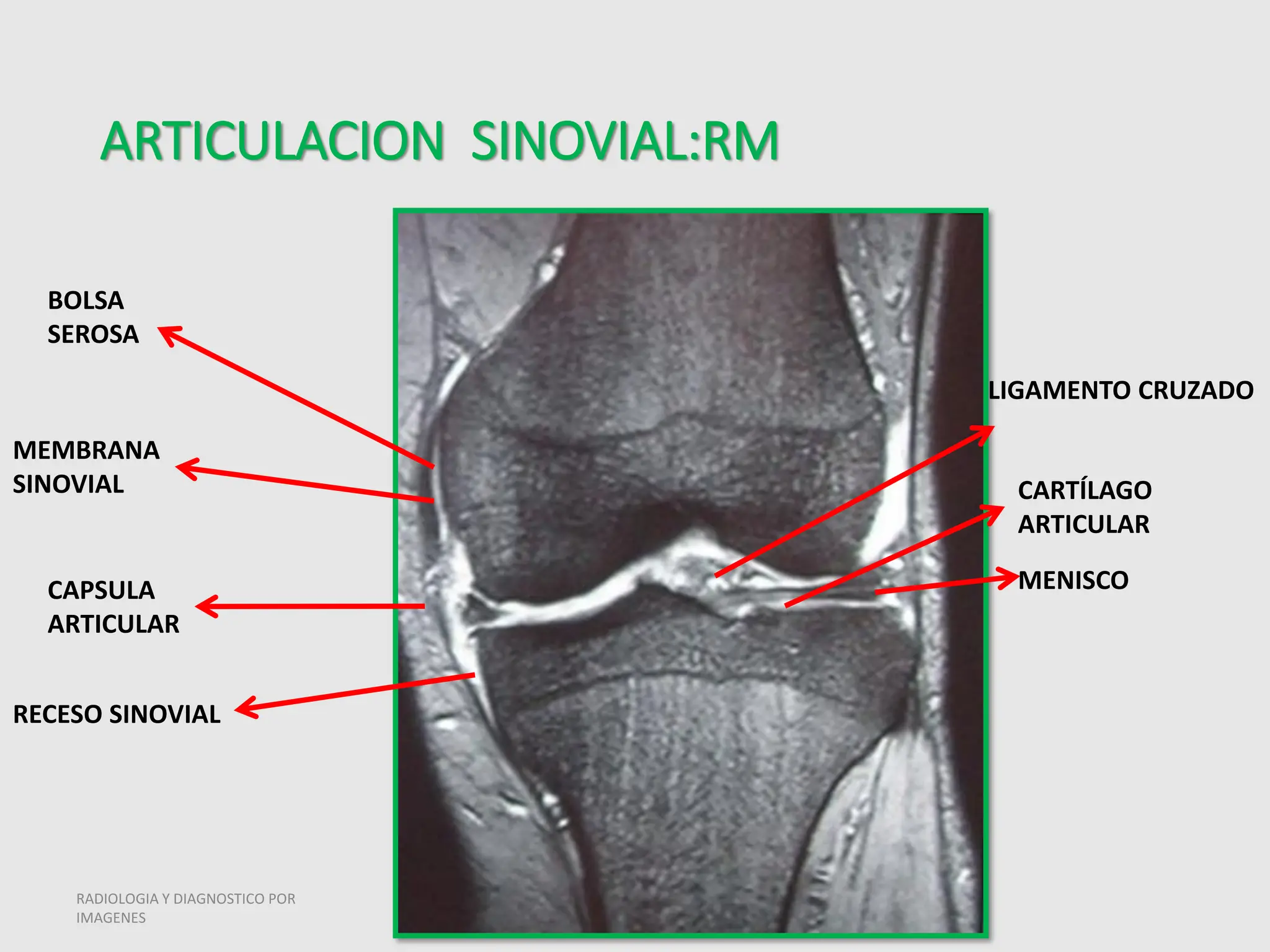SISTEMA OSTEOARTICULAR ANATOMIA Y PATOLOGIA 2.pdf
