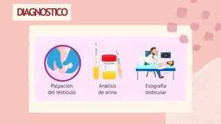 La Orquitis sistema reproductor masculino | PPTX