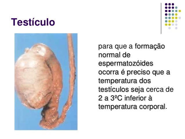 SISTEMAS REPRODUTIVOS